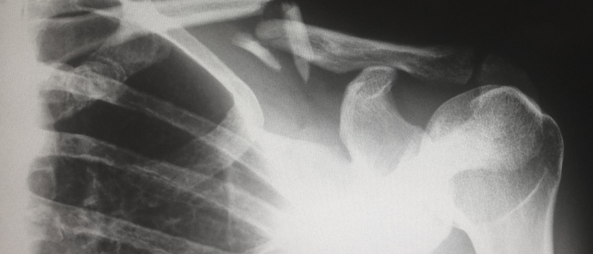 Workers' Compensation - FMGR Attorneys